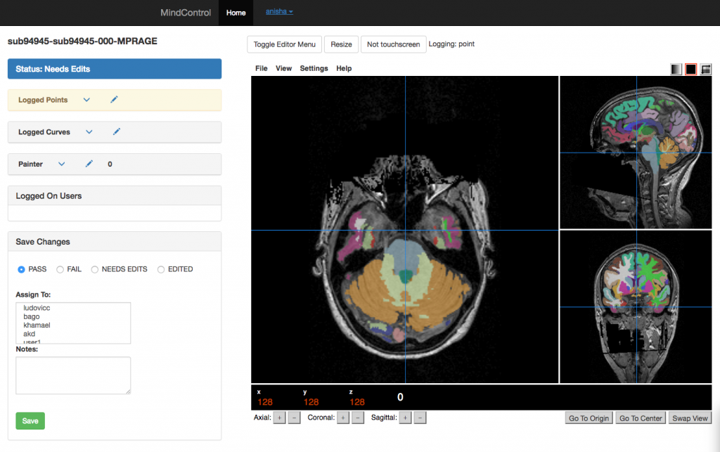 Projects | Neurohackademy