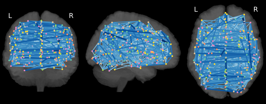 Projects | Neurohackademy